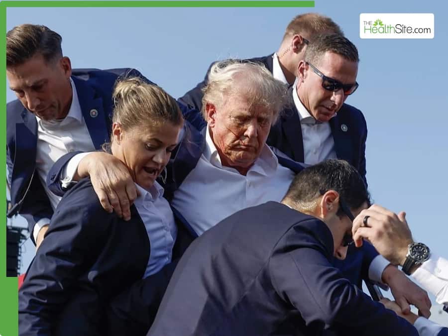 Donald Trump Health News: Facial Droop To Hand Bruises - What Is ...