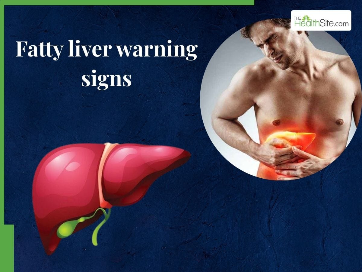 Fatty Liver Warning Signs in Your Hands: 5 Warning Signs Your Liver Is ...