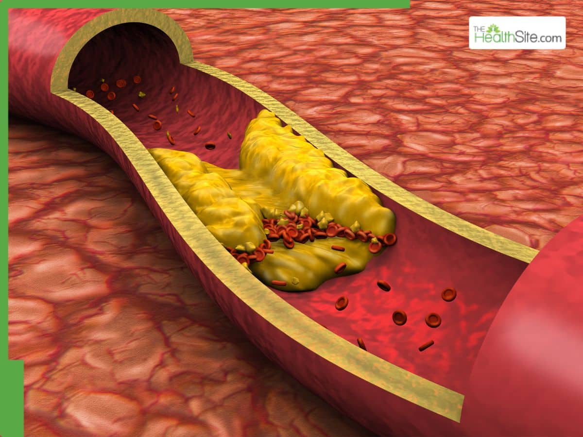 High Cholesterol Control Tips: 7 Empty Stomach Drinks To Flush Out Bad ...