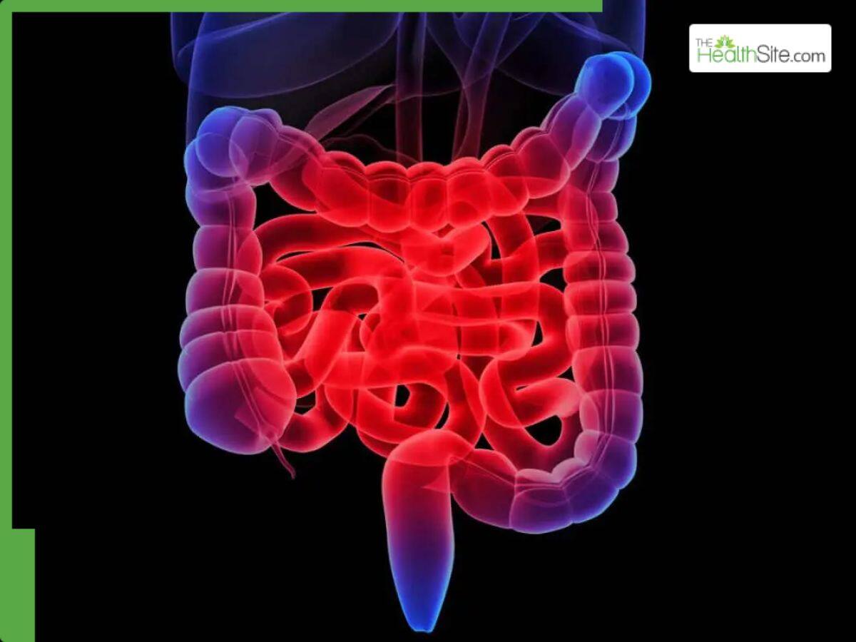 7 Warning Signs Of An Inflamed Gut That Can Affect Even Healthy Eaters ...