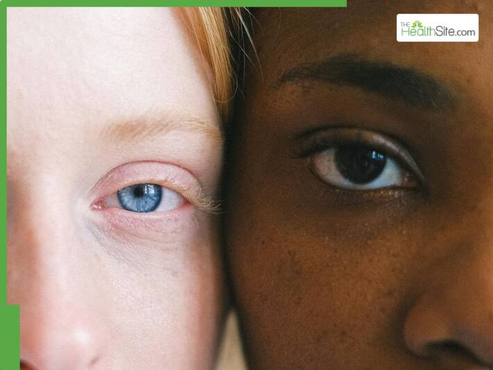 Heart Attack Symptoms: 5 Warning Signs That Appear On Your Hands And ...