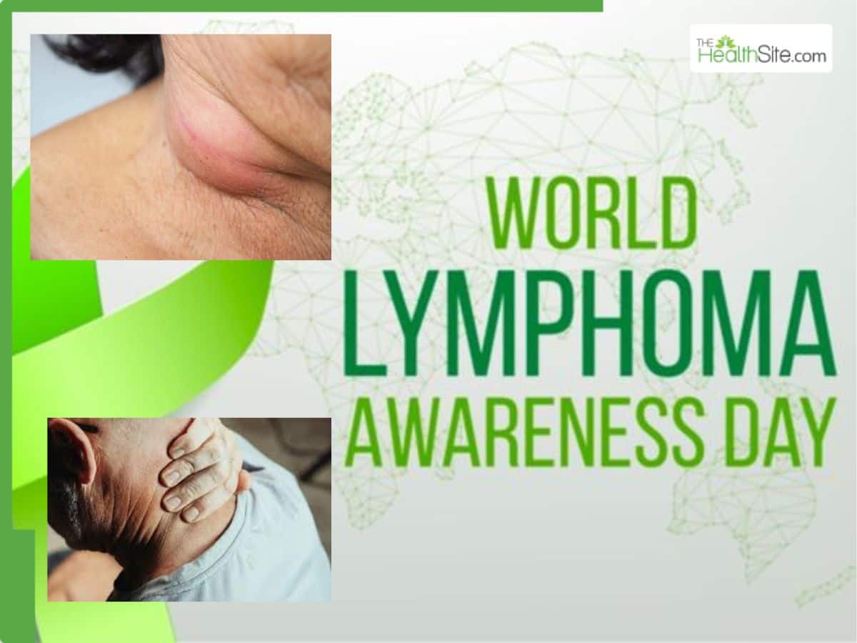 World Lymphoma Awareness Day: 5 Early Warning Signs of Lymphoma You ...