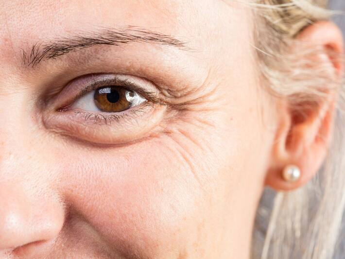 Chehre Par Nimbu ka Ras Lagane ke Fayde | रोज रात में चेहरे पर नींबू का ...