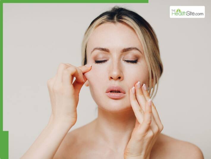 5 Simple Ways To Remove Smile Lines Naturally At Home | TheHealthSite.com