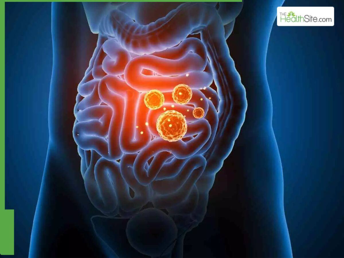 7 Warning Signs Of Gut Inflammation That Show Up on Your Skin ...