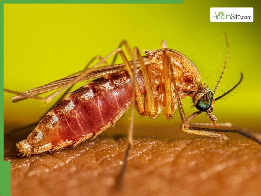 Rift Valley Fever Envelops Senegal: 140 Confirmed Cases, 18 Deaths As ...