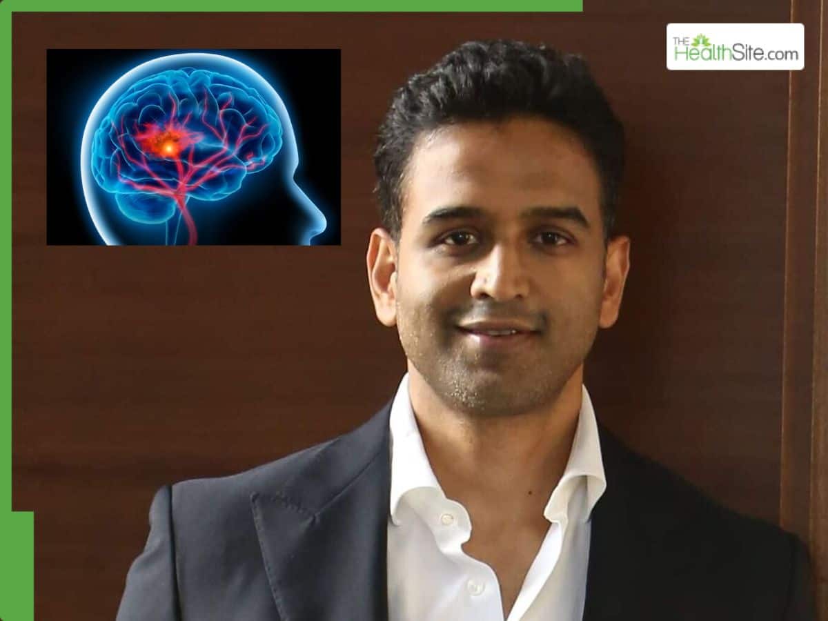 Nithin Kamath Shares His Stroke Experience And Warns Against Ignoring ...
