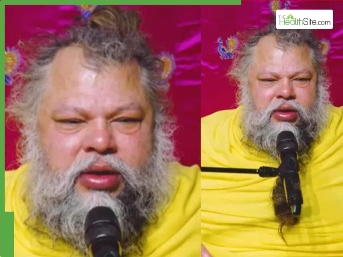 Premanand Maharaj Health Update: Swollen Eyes, Red Face - What Is the ...