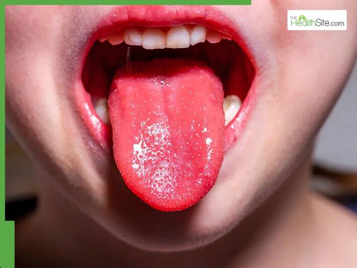 5 Warning Signs On Your Tongue That Could Point To Dangerous Diseases ...