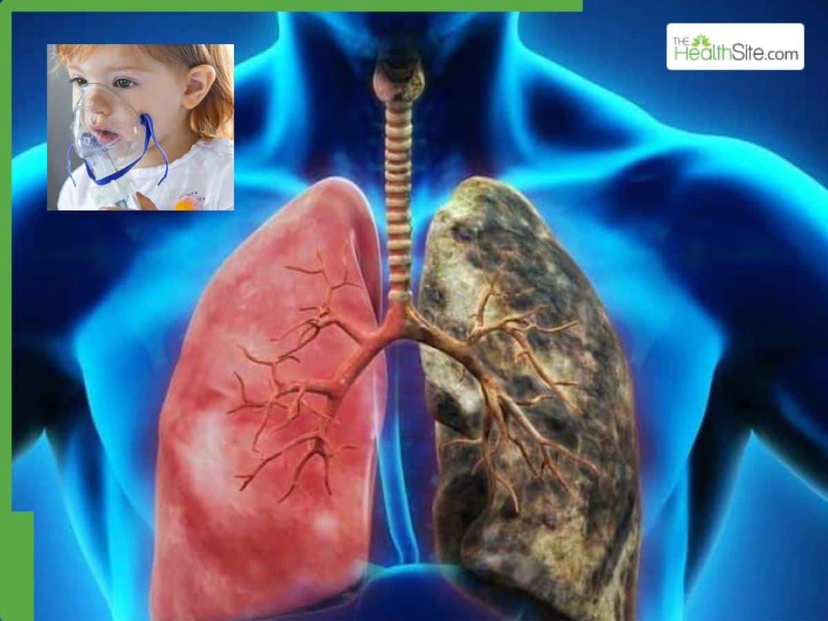 Delhi AQI Crosses 400: Diwali Fireworks Trigger Hazardous Air Pollution and 5 Major Respiratory ...