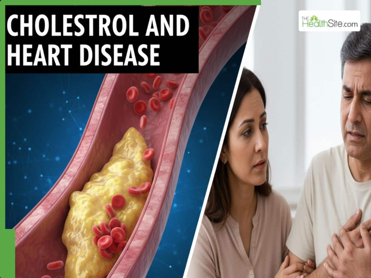 Cholesterol And Heart Disease: THIS Gene Therapy May Lower Bad LDL And ...