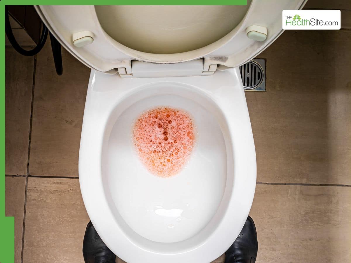 What Foamy Urine Can Tell You About Your Kidney Health, According To ...
