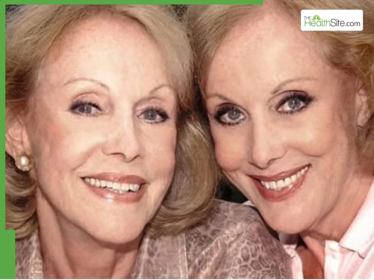 Kessler Twins Die By Assisted Suicide At 89: What Does It Mean ...