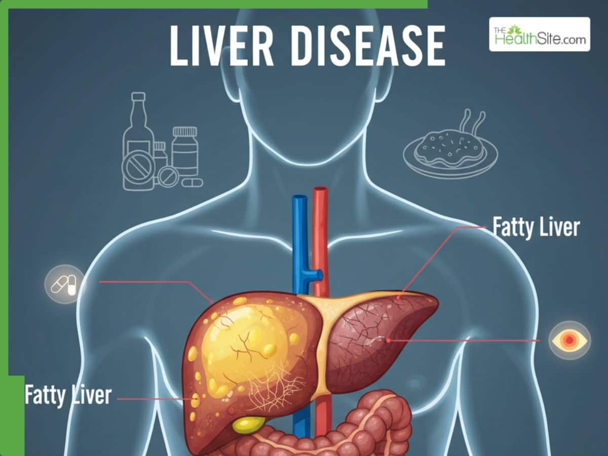 Liver Disease: People With THIS Blood Type Are At Higher Risk, Warns ...