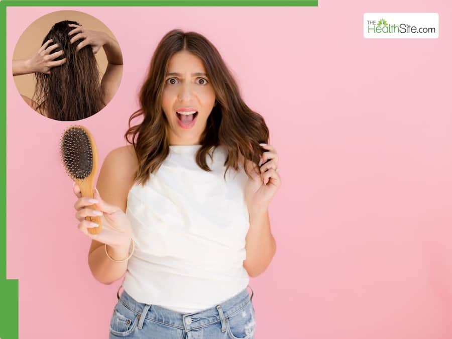 PCOD Induced Hairfall Solutions: How To Grow Hair in Bald Patches ...