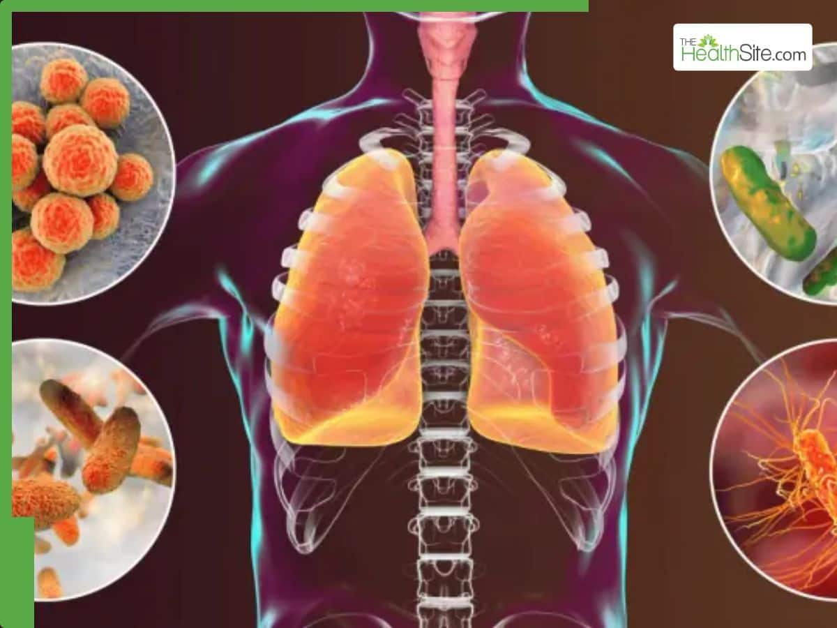 Pneumonia Symptoms: 5 Warning Signs Your Lungs Are Completely Filled ...