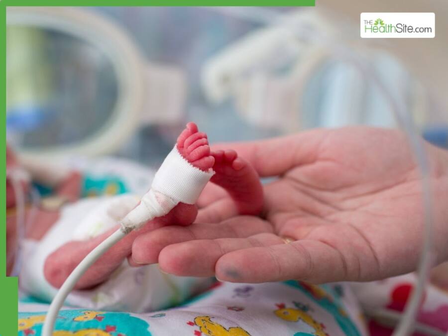 World Prematurity Day 2025: Long-Term Health Risks Parents Should Know ...