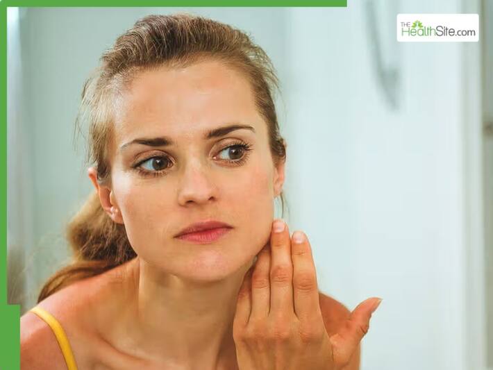 Fatty Liver Symptoms On Face: 5 Early Facial Changes You Should Not ...