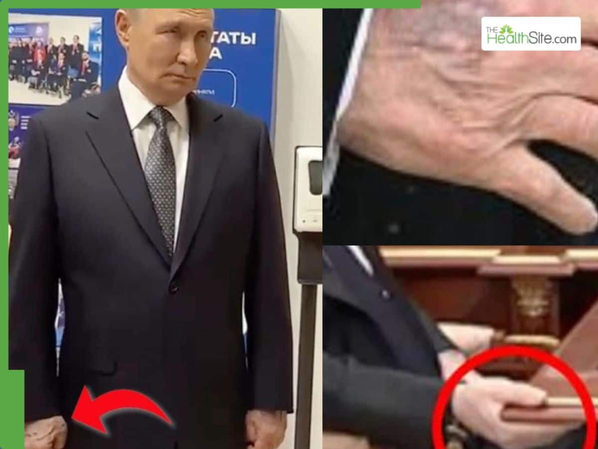 Vladimir Putin Meets Xi Jinping: Viral Video Shows Swollen Hand And ...