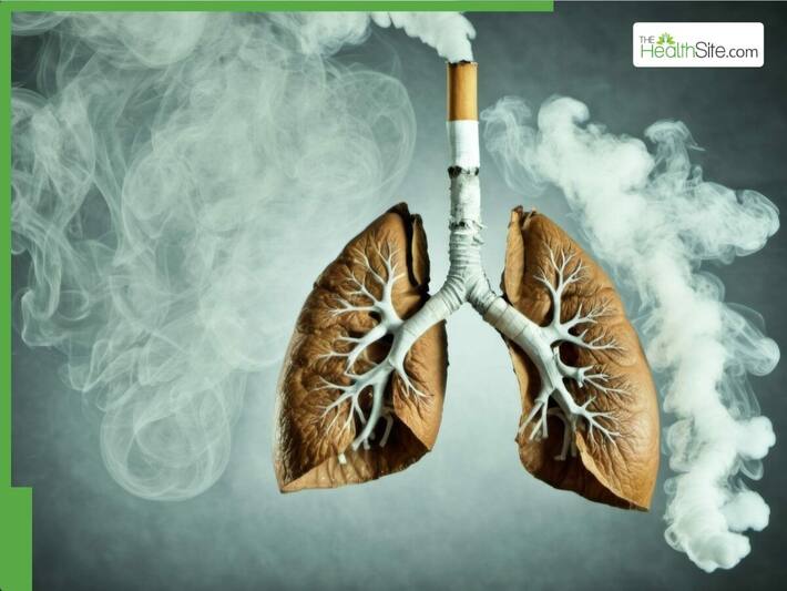 Poor AQI: Essential Safety Tips For Smokers | TheHealthSite.com