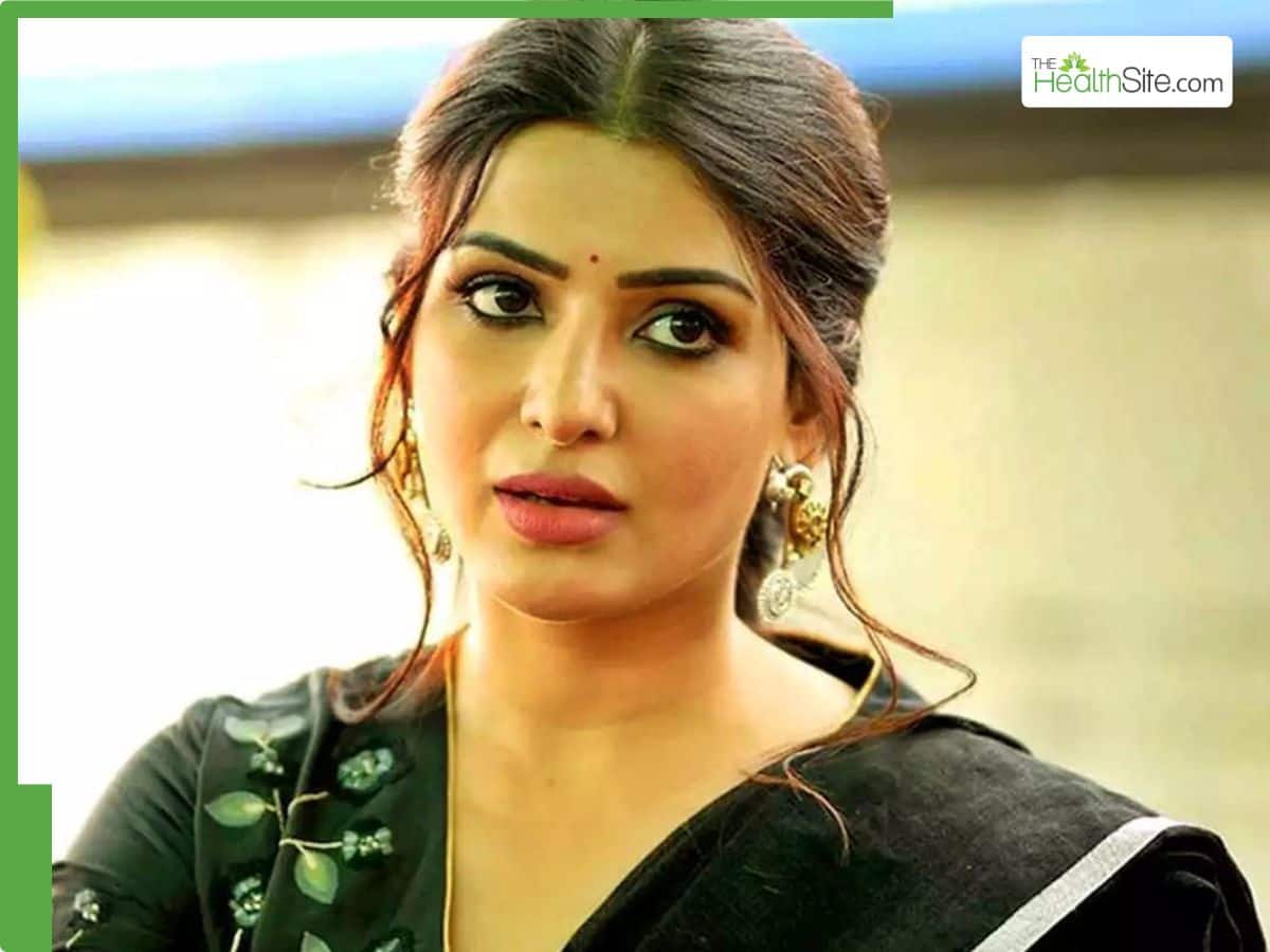 Samantha Ruth Prabhu’s Myositis journey: About The Autoimmune Condition ...