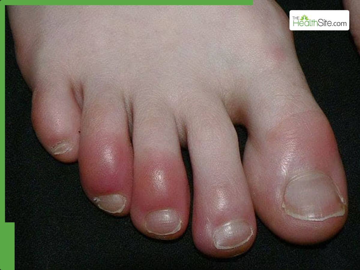 Cold Feet Even With Socks On? Expert Reveals 8 Winter Reasons You ...