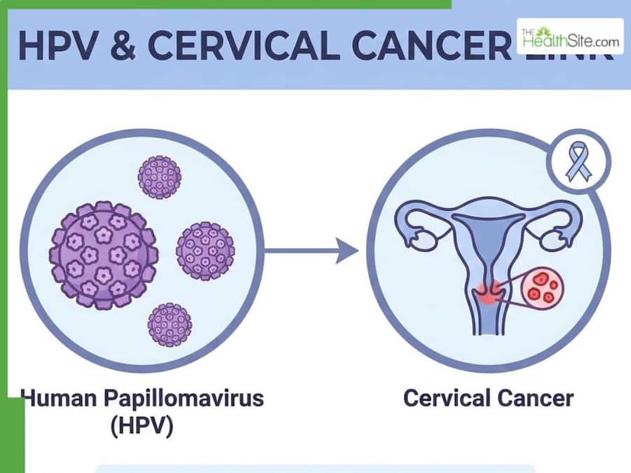 HPV And Cervical Cancer: Doctor Explains How The Virus Spreads And Why ...