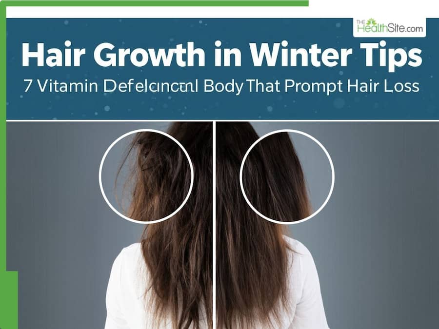 Hair Growth In Winter Tips: 7 Vitamin Deficiencies In The Body That ...