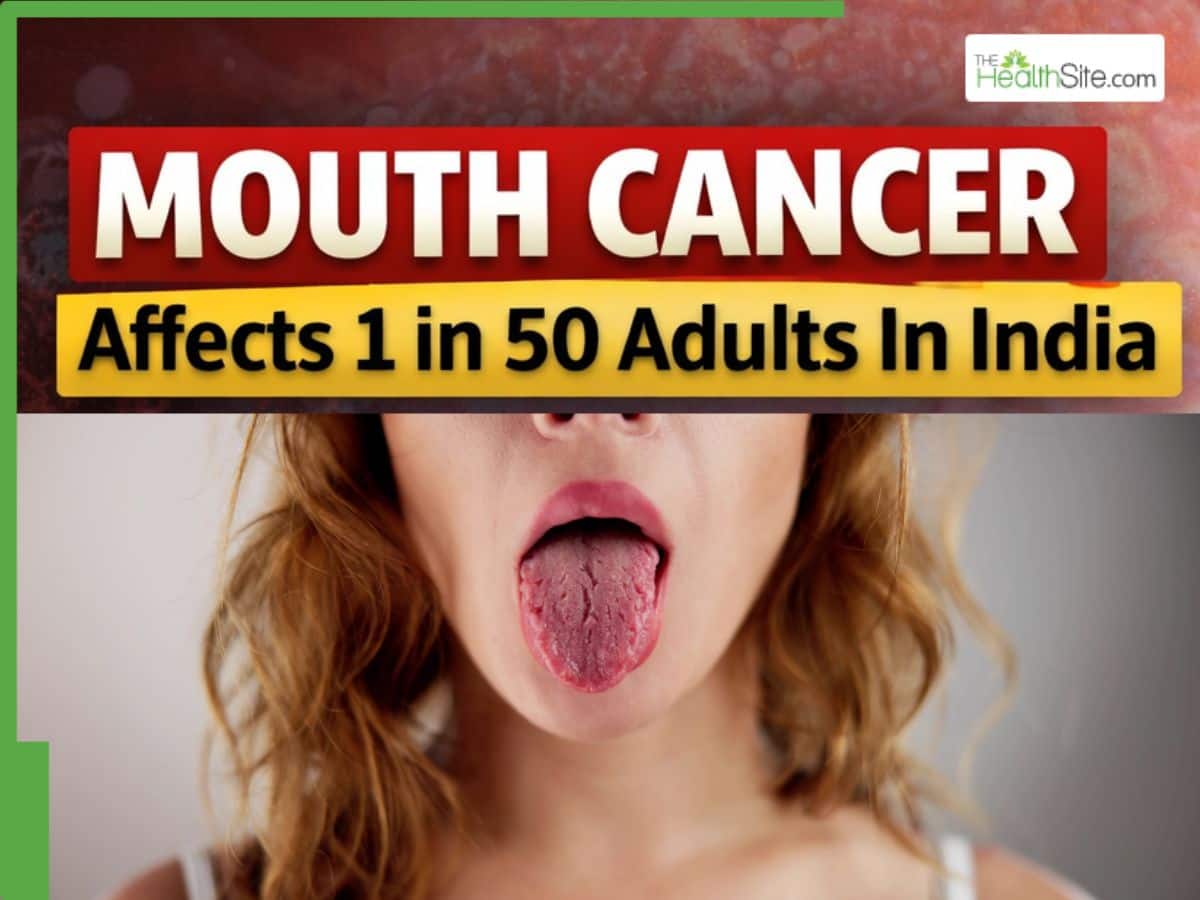 Mouth Cancer Affects 1 in 50 Adults In India: Persistent Tongue ...