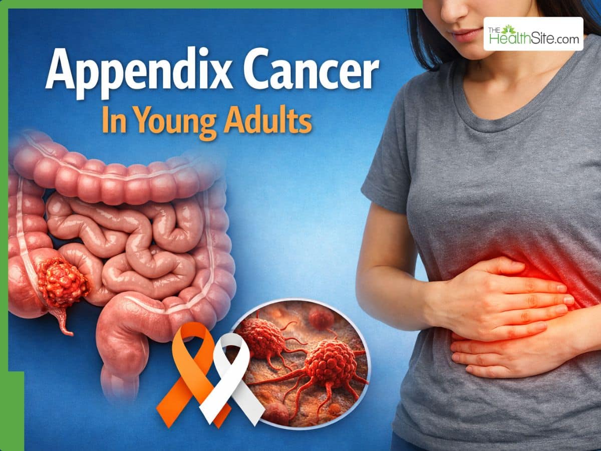 Appendix Cancer Is Rising In Young Adults: Causes, Symptoms, Types And ...