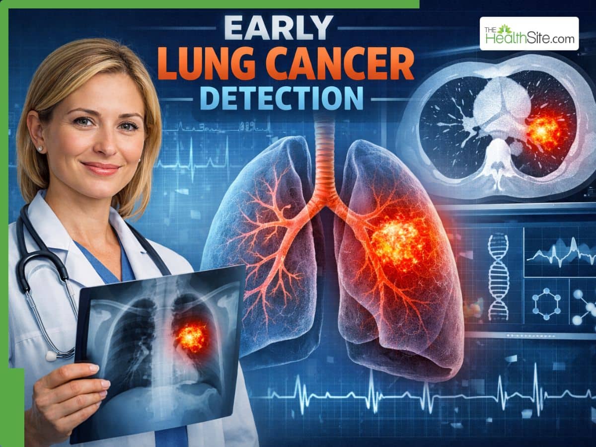 Early Lung Cancer Detection: Why Low-Dose CT Scan (LDCT) Is The Gold ...