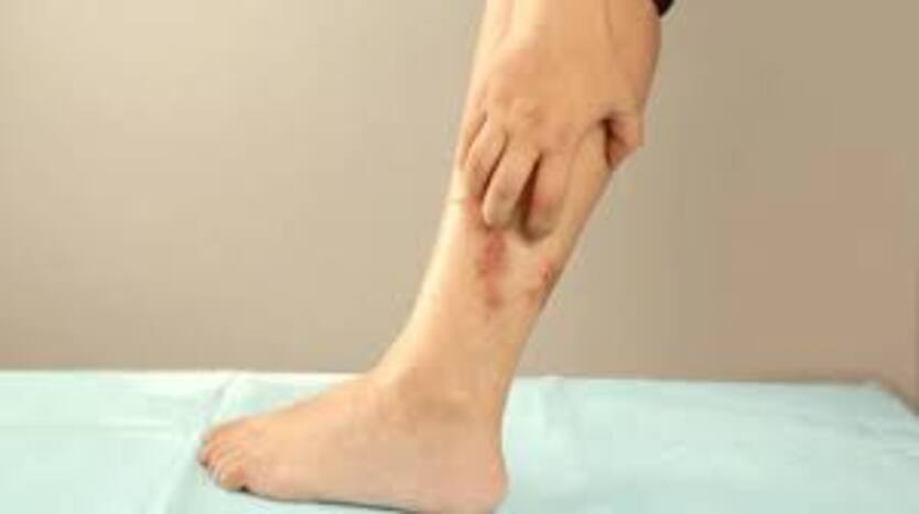 Clogged Leg Arteries Symptoms: 5 Warning Signs of Peripheral Artery ...