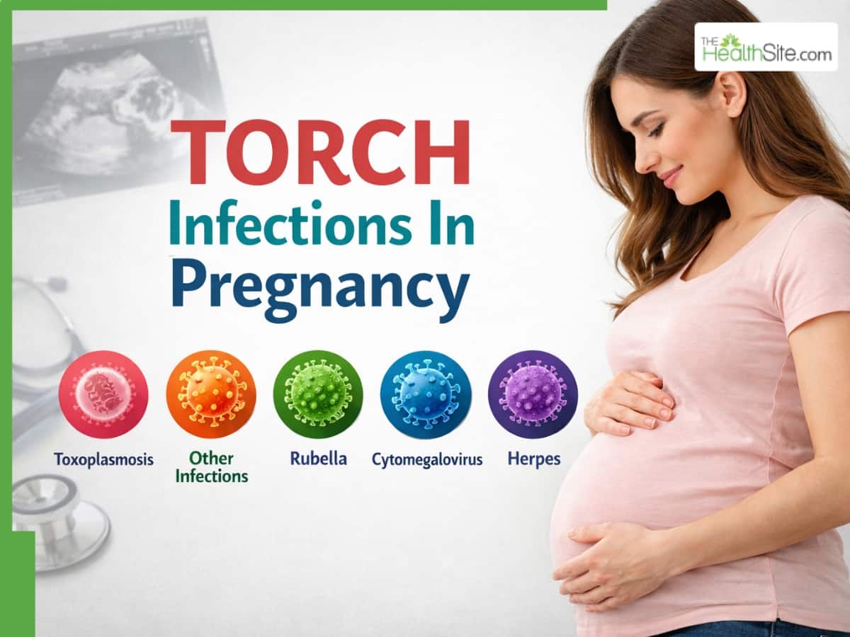 TORCH Infections In Pregnancy: Symptoms, Risks To Baby, Tests ...