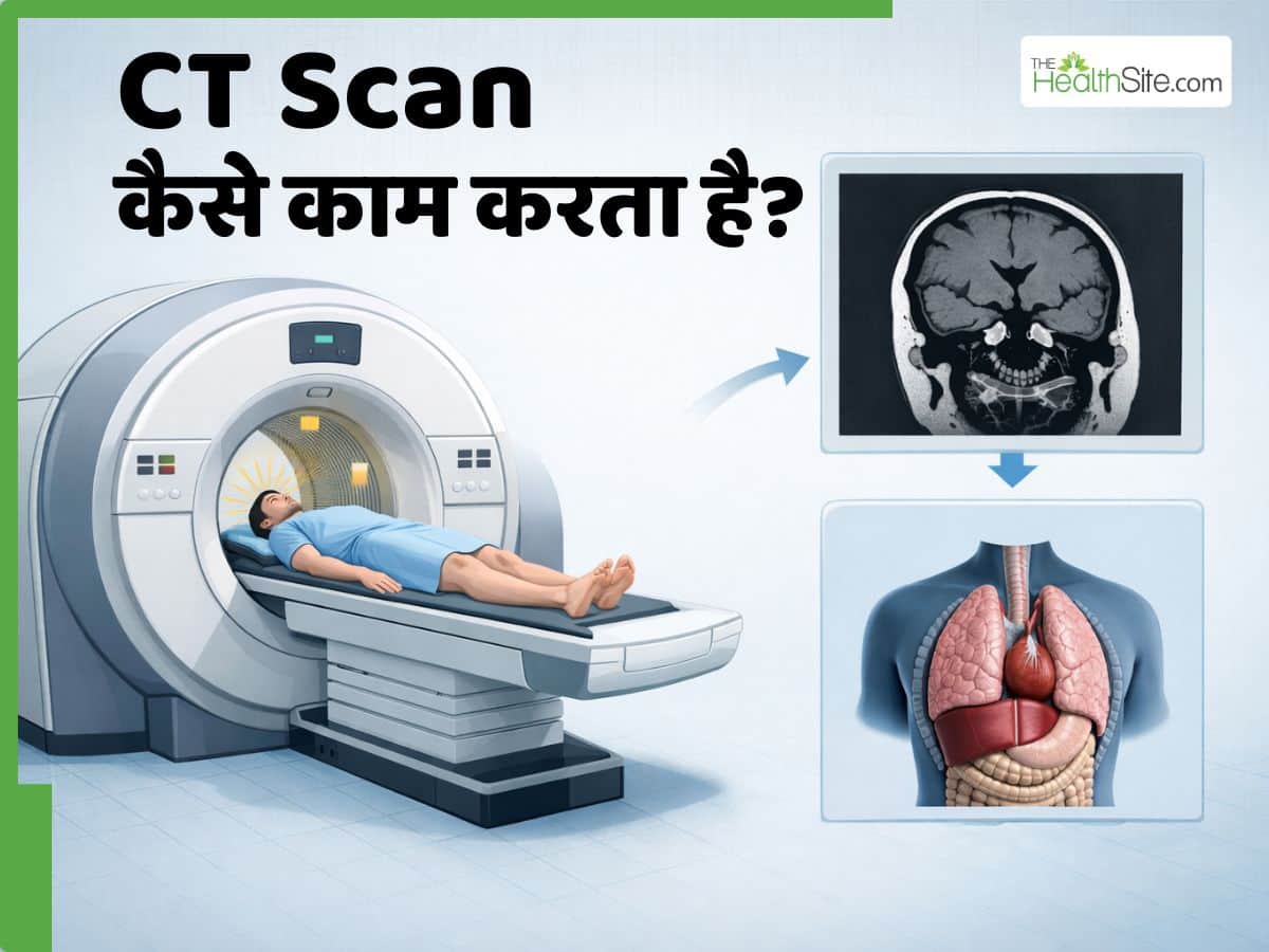 CT Scan क्या होता है? जानें डॉक्टर इस टेस्ट को कराने की कब देते हैं ...