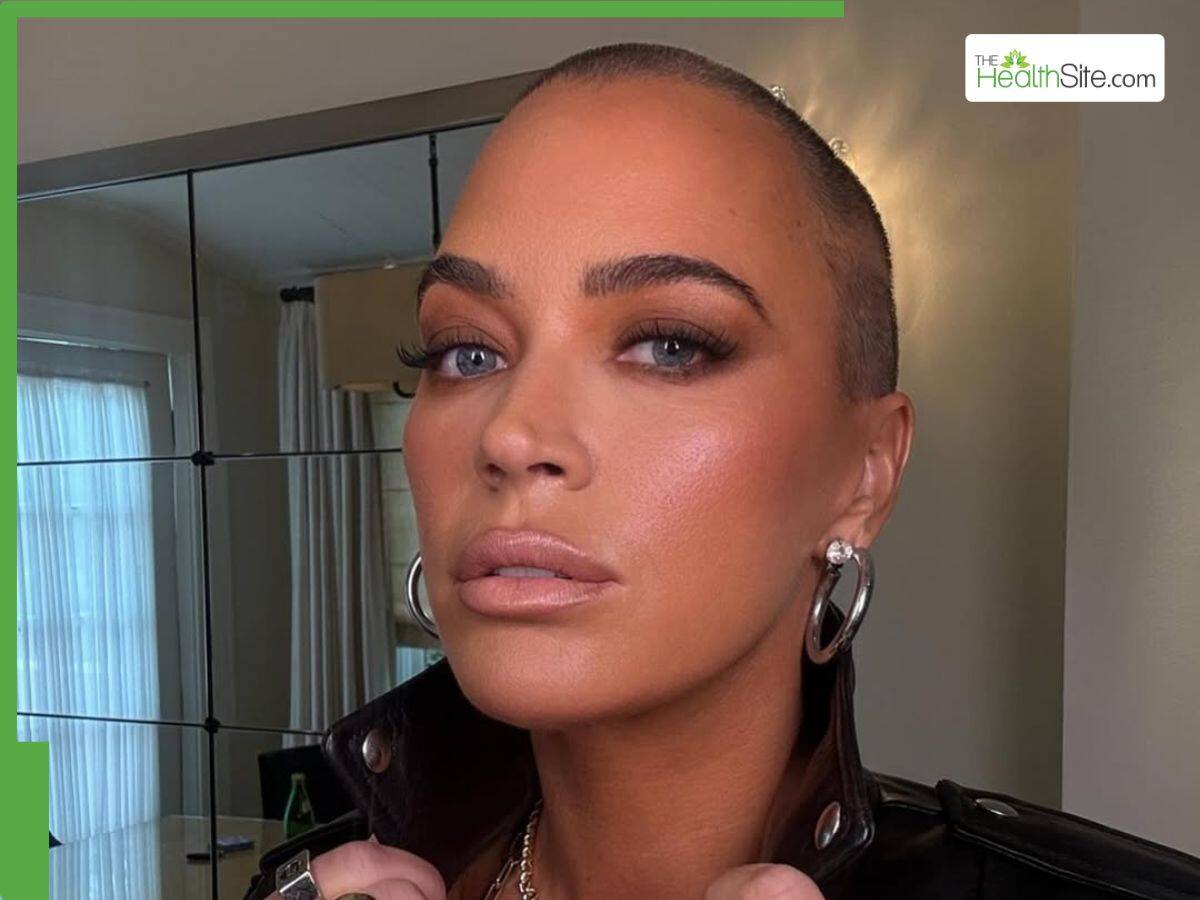 Teddi Mellencamp diagnosed with Stevens-Johnson syndrome: What to know ...