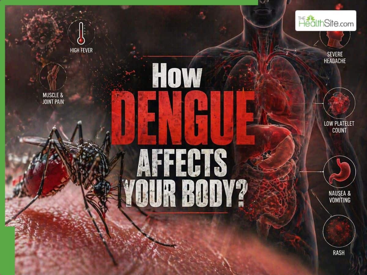 What happens in your body after being stung by a dengue mosquito ...