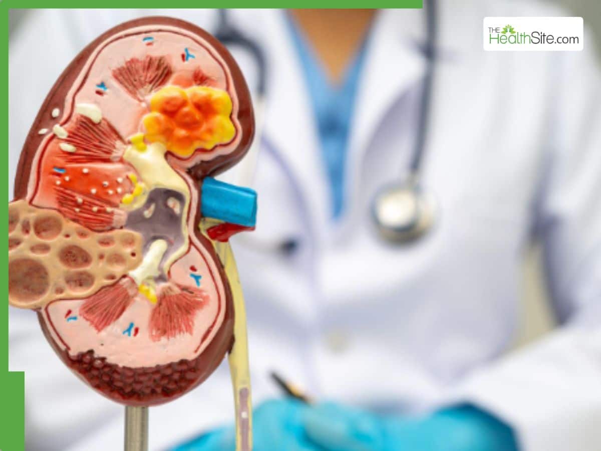 Kidney and urinary health: Warning signs, prevention tips, and daily ...