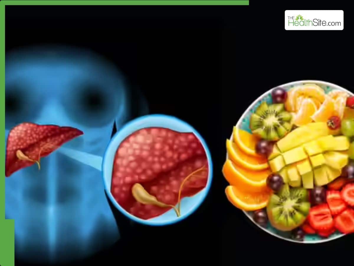 World Liver Day 2026: Liver detox myths vs fact, do you really need a ...