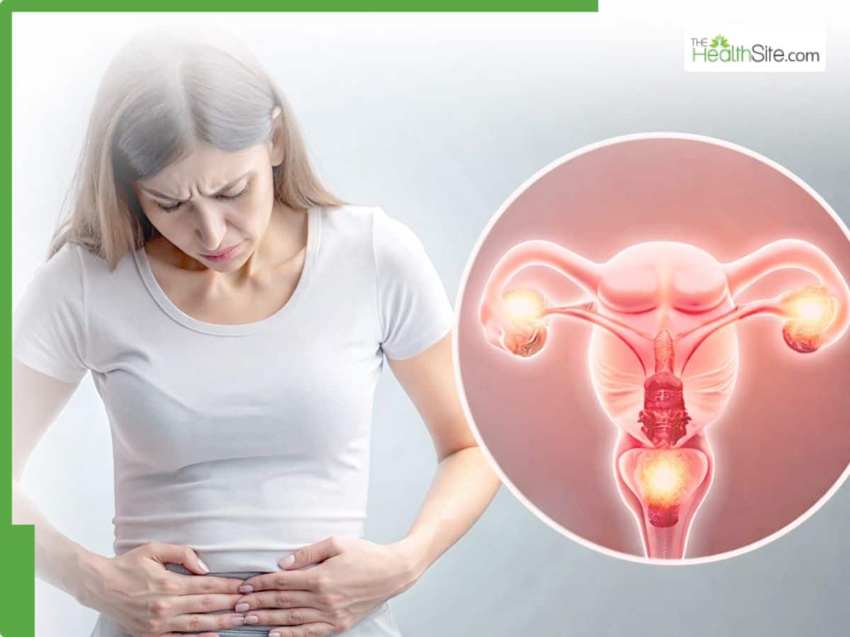 PCOS in women after 25: Gynaecologist explains early warning signs your ...