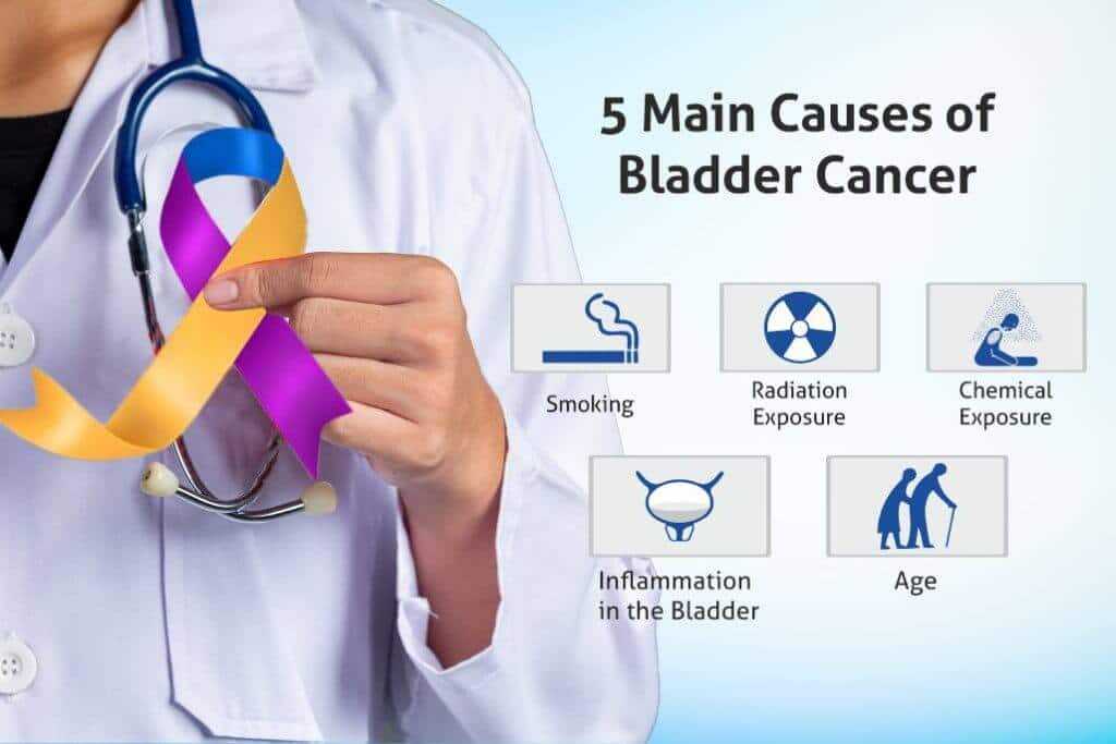 Recurrent UTIs within 6 months may be early warning sign of bladder ...