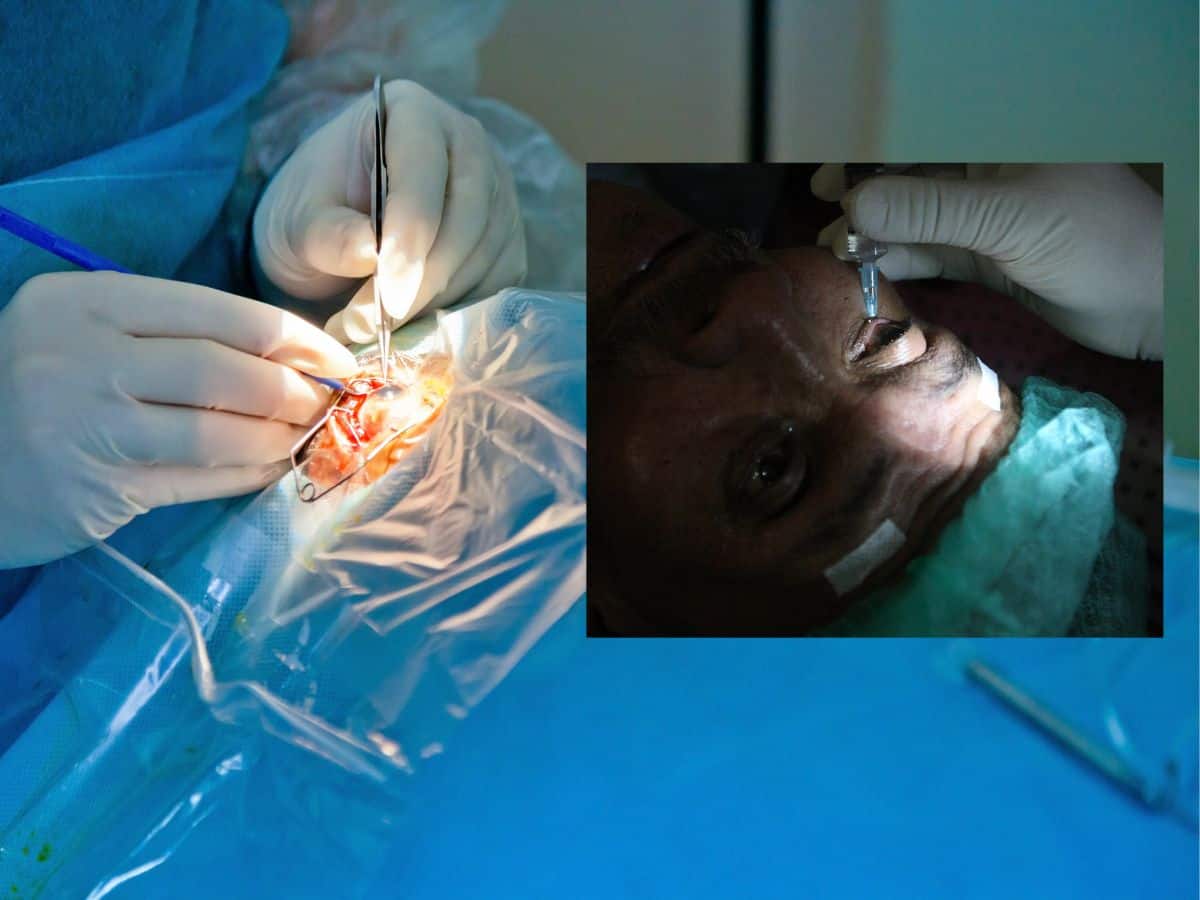 Cataract prevention: Eye doctor shares 6 daily habits to protect your ...