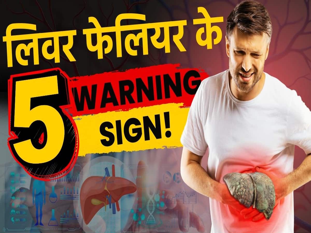 Liver Failure Warning Sign: लिवर खराब होने पर दिखते हैं इस तरह के लक्षण ...